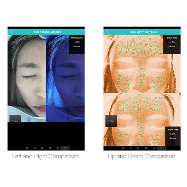 Quality 10.6kg Gw Face Skin Analysis System 20mega Pixels Fda Fc Certificate for sale