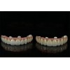 china Biocompatible Titanium All On 6 Dental Implants Bridge For Tooth