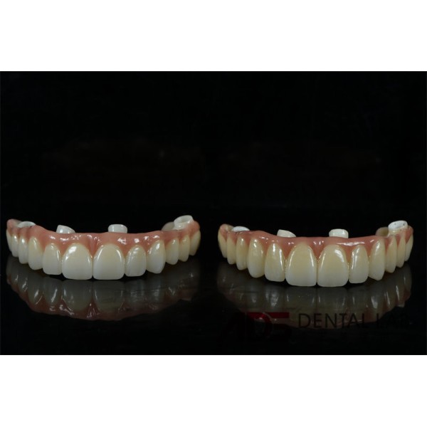 Quality Biocompatible Titanium All On 6 Dental Implants Bridge For Tooth for sale