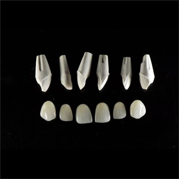 Quality Dental Lab Teeth Feldspathic Porcelain Veneers Custom Shaped for sale