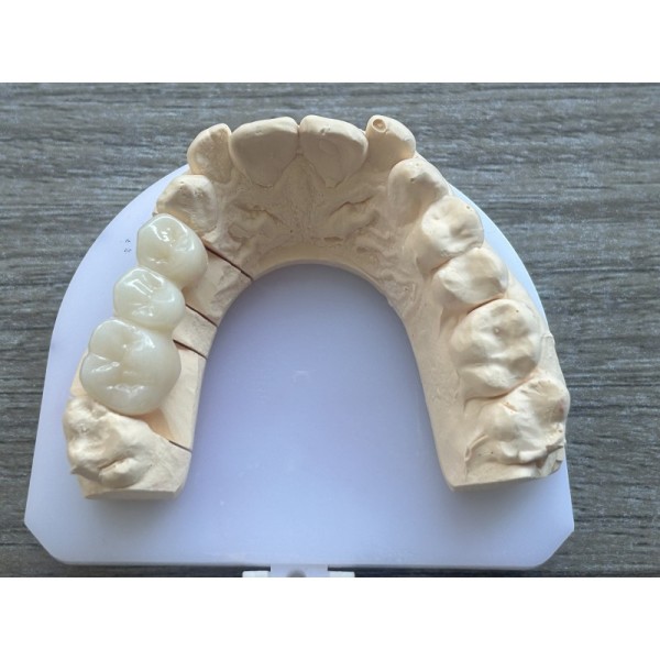 Quality Full Zirconia Crown with 1200 MPa Strength, High Aesthetic Translucency, and CAD/CAM Precision Milling for Dental Restoration for sale