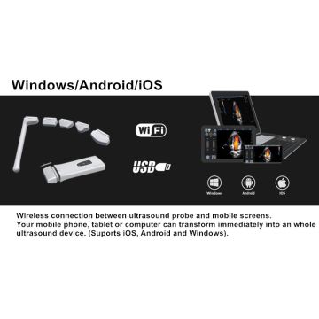 Quality Cardiac Handheld Ultrasound Machine Wireless Ultrasound Probe Human Or Vet Usage for sale