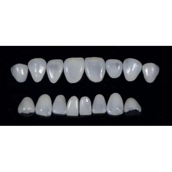 Quality Durablity CAD-CAM Dental Composite Veneers Highly Detailed Accurate for sale