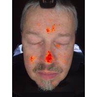 Quality 3D Digital Skin Analyzer Magic Mirror Tester for Cosmetic Therapist Clinic for sale