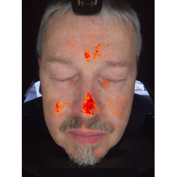 Quality 3D Digital Skin Analyzer Magic Mirror Tester for Cosmetic Therapist Clinic for sale