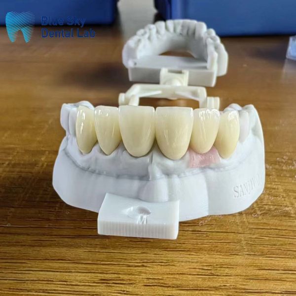 Quality Highly Translucent Layered Zirconia Crowns Natural With Implant Crown for sale