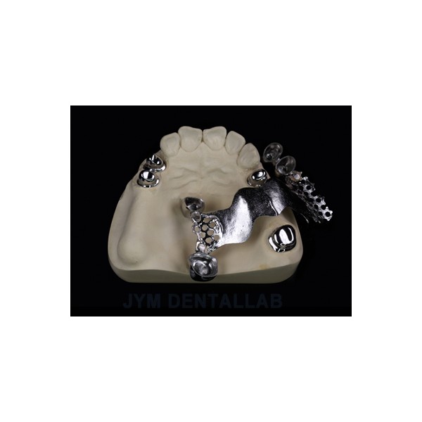Quality Telescope crowns and denture for sale