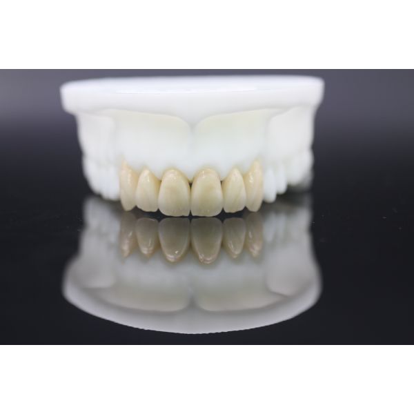 Quality Porcelain Dental Crown Tooth-Shaped Cap for Restoring Shape and Enhancing for sale