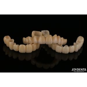 Quality Natural Looking Porcelain Layered Zirconia Bridges Wear Resistance High for sale