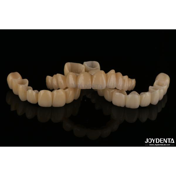 Quality Natural Looking Porcelain Layered Zirconia Bridges Wear Resistance High Biocompatibility for sale