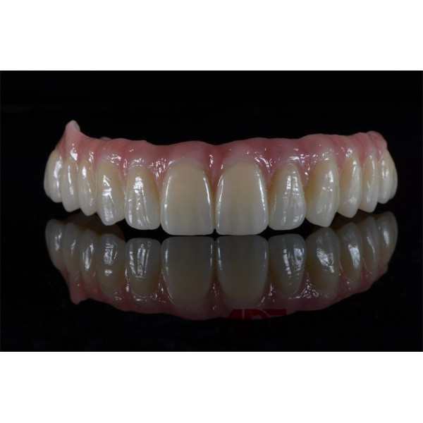Quality China Dental Lab All On 4 Bridge Full Arch Implant Bridge In Demistry for sale