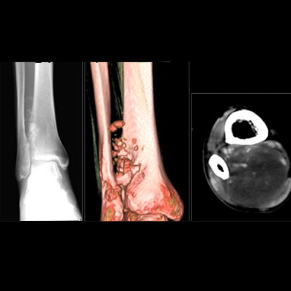 Quality KND-A / F Medical X Ray Films for sale