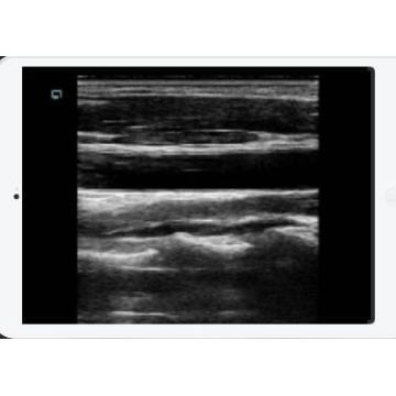 Quality Mini Portable Handheld Ultrasound Machine Cardiac Convex Detachable Transducers for sale