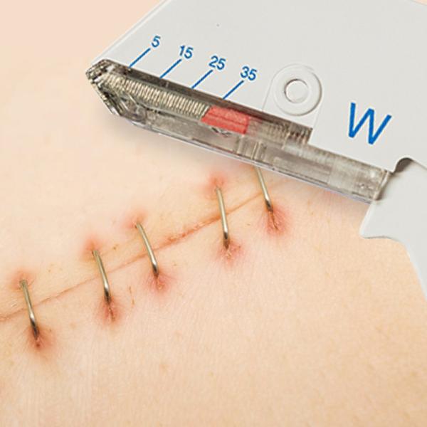 Quality Disposable Plastic Skin Stapler Surgery For Dogs Customized for sale
