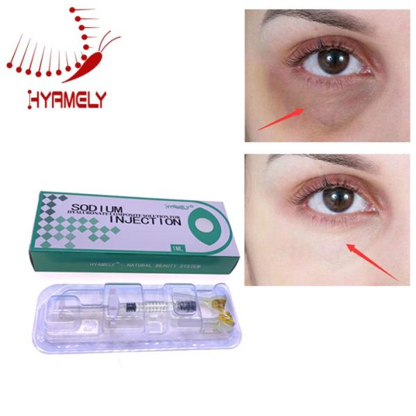 Quality Get Rid Of Dark Circles Injecting Hyamely Filler Solution To Removing for sale