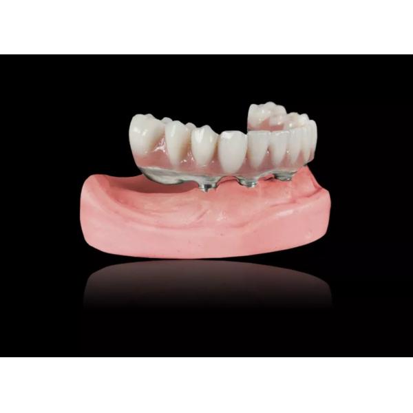 Quality Implant Titanium Bar Removable Dentures Titanium Alloy Implant Bar Overdenture for sale