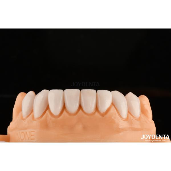 Quality Strong Bond With Tooth Enamel For Secure Fit Dental Veneers Customization For Personalized Shades To Match Natural Teeth for sale