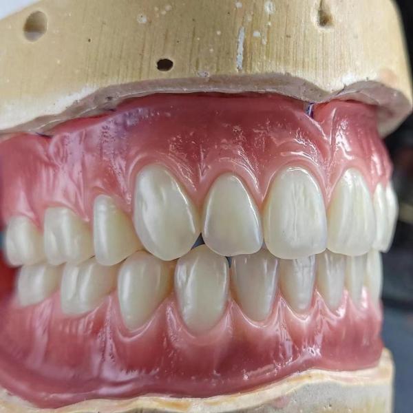 Quality Dental Removable Complete Denture Ivoclar Full Denture Acrylic Teeth for sale