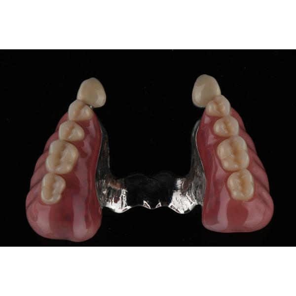 Quality Stain Odor Resistant Full Acrylic Denture Natural Looking Acrylic Resin Denture Teeth for sale