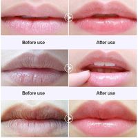 Quality Custom Vegan Anti Wrinkle Konjac Lip Patch Cruelty Free for sale