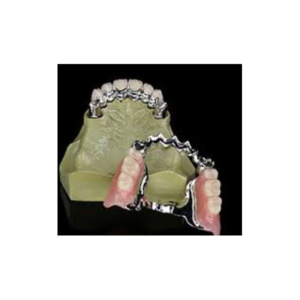 Quality Long Term Use Customized Key And Keyway Dental With High Strength for sale