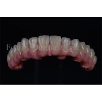 Quality Long Lasting Titanium / Zirconia All On 4 All On 6 Rapid Recovery 1-2 Weeks for sale