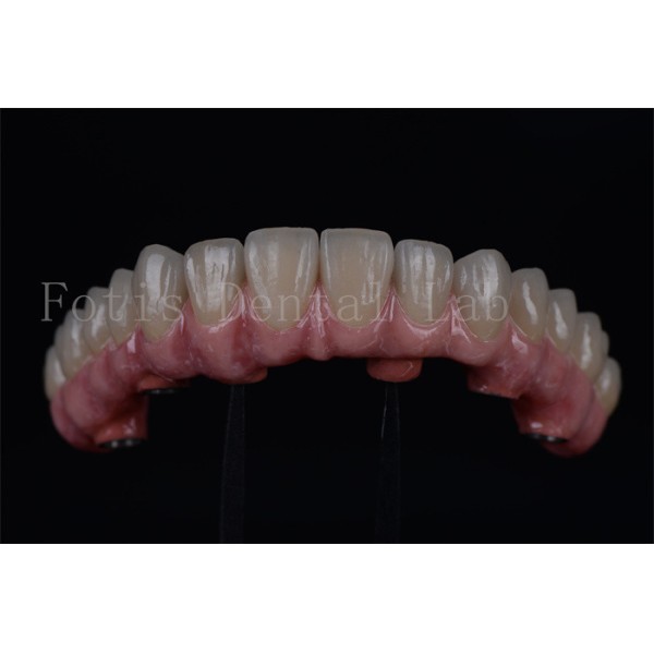 Quality Long Lasting Titanium / Zirconia All On 4 All On 6 Rapid Recovery 1-2 Weeks for sale