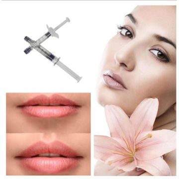 Quality Revolax Hyaluronic Acid Dermal Filler Injection 3ml 5ml 10ml for sale