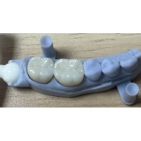 Quality Full Zirconia Dental Zirconia Material with High Strength and Biocompatible for sale