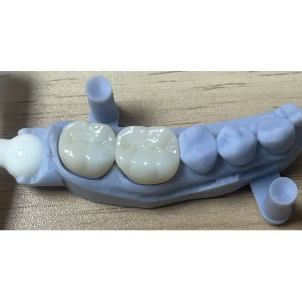 Quality Full Zirconia Dental Zirconia Material with High Strength and Biocompatible Properties for sale