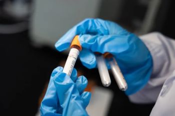 China Factory - Shanghai Orsin Medical Technology Co., Ltd.