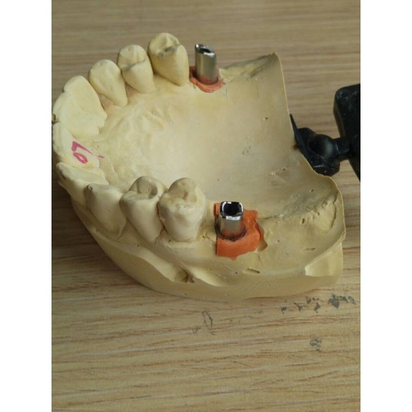 Quality Custom-made Biocompatible Titanium Abutment with High Durability for Dental for sale