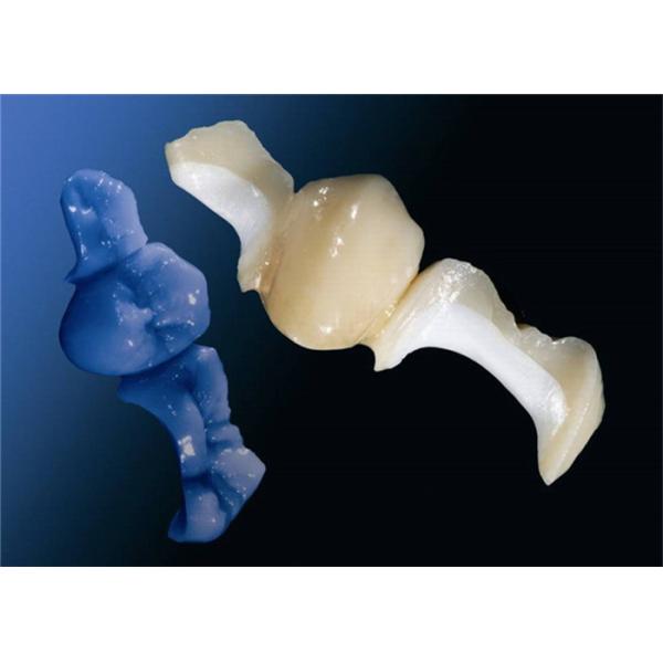 Quality Customized OEM Polishing All-Ceramic Dental Crown Veneer Inlay Onlay for sale