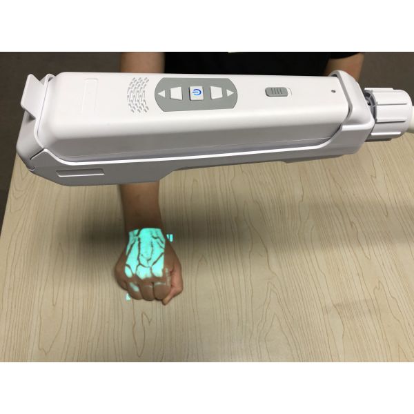 Quality High Image Resolution Vein Locator Device for sale