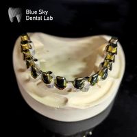 Quality Gold Pure Titanium Malo Bridge Metal Frame Malo Implant Bridge for sale