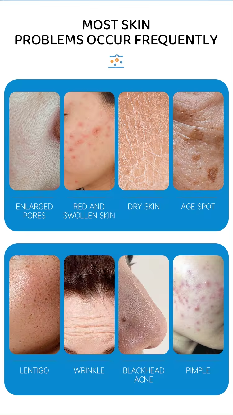 treatment range
