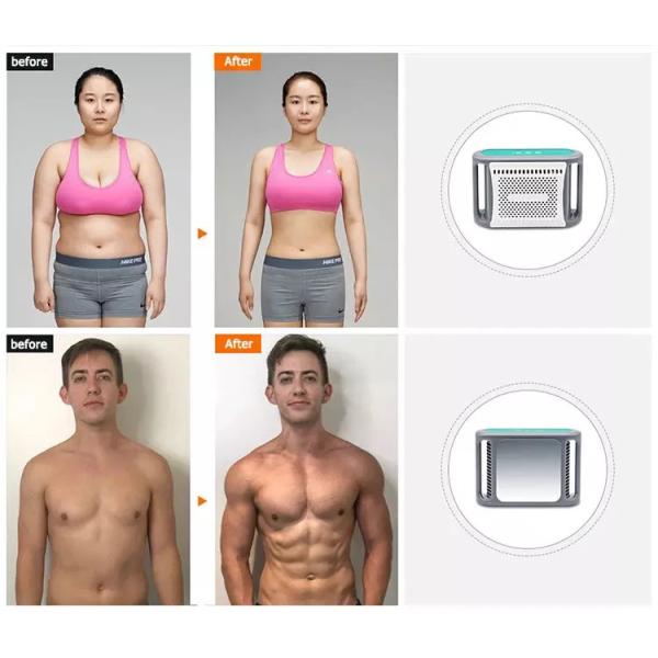 Quality cryolipolysis slimming machine for sale