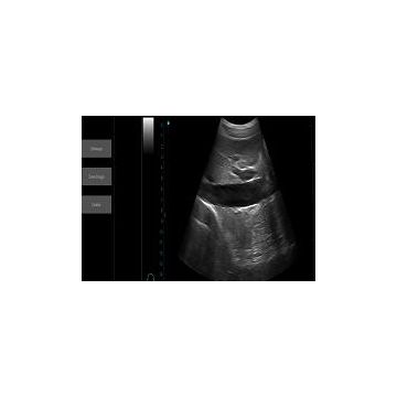 Quality USB Ultrasound Probe Digital Portable Ultrasound Scanner With Probe of Frequency for sale