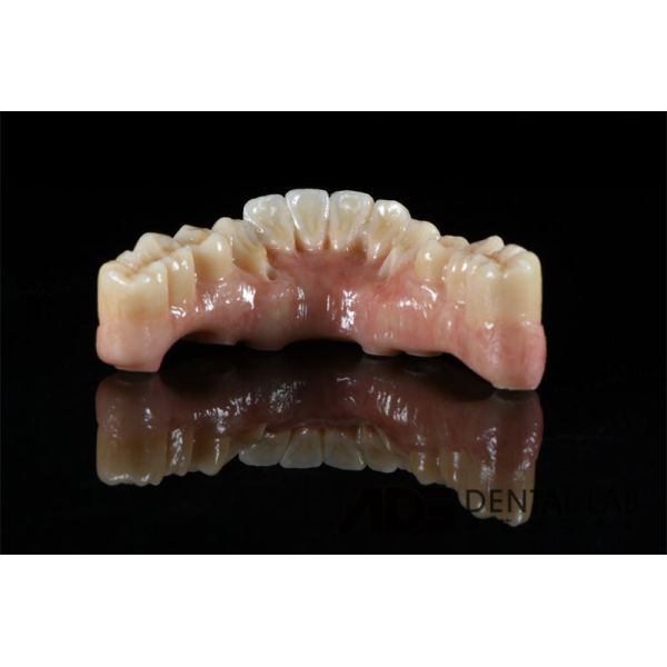 Quality OEM Cylindrical Titanium Full Bridge Dental Implants All On 4 6 for sale