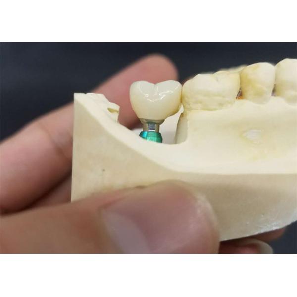 Quality Ultra Hard Colour Stability OEM Dental Implant Crown Easy Maintain for sale