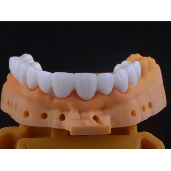 Quality High Strength Zirconia Tooth Crown Ultra Translucent With Long Term Stable for sale