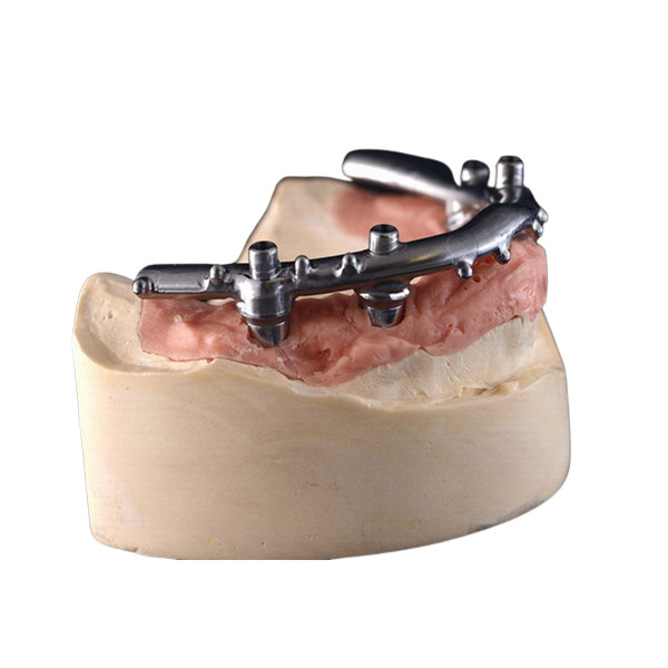 Quality High-Density PFM Dental Implants Dentures Strong Hardness Long Lasting​ for sale