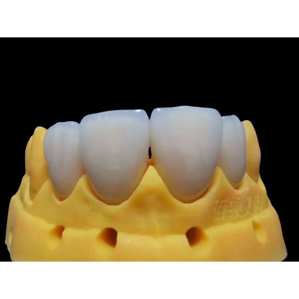 Quality Tear Resistant Fitting Full Zirconia Crown Customizable Safe To Use for sale