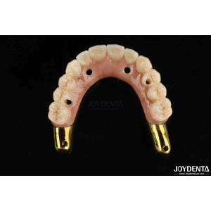 Quality Wear Resistance Zirconia Hybrid Bridge With Ti-Bar Compatible Natural Teeth And for sale