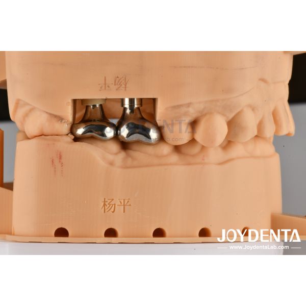 Quality Silver Dental Implant Abutments Customizable Diameter Height CAD CAM Technology for sale