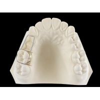 Quality Flexible Band And Loop Space Maintainer Adjustable Orthodontic Functional for sale