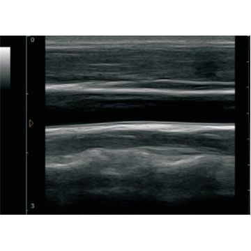 Quality 12 " LCD Screen Portable Ultrasound Device Digital High Resolution With B, B+B, for sale