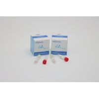Quality CE PCR Swab Test Kit Hepatitis B And C Test Kits Clinical Diagnosis for sale