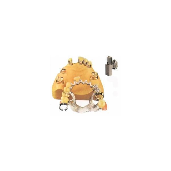 Quality Telescope crowns and denture for sale