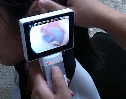 Quality Rechargeable Portable Otoscope Ophthalmoscope Dermatoscope With SD Card Output for sale